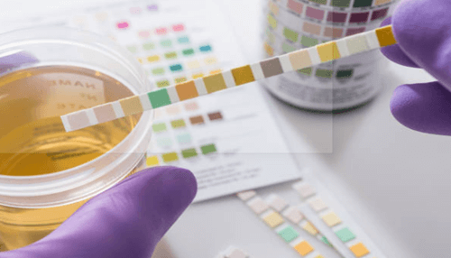 The Differences Between DOT vs Non-DOT Drug Testing Programs The ...